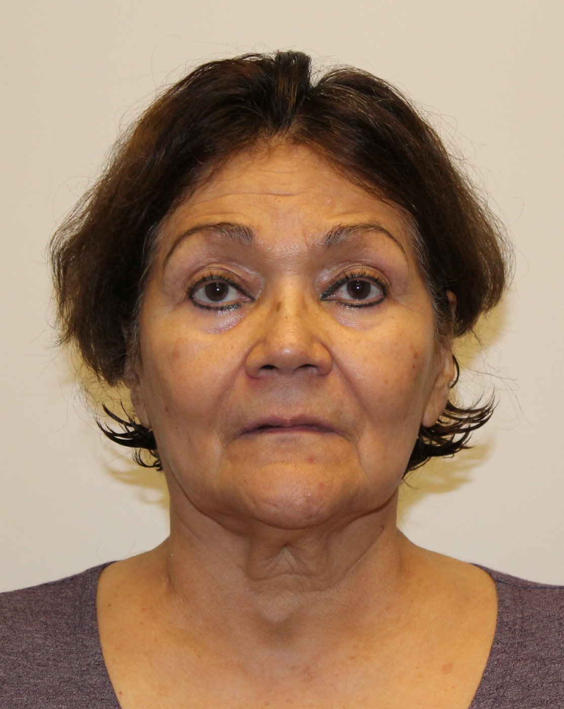 Hempstead Woman Charged with Practicing Dentistry without a License - Long Island Life & Politics